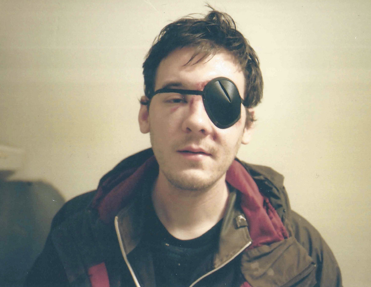 1999 In a Nutshell | Shone