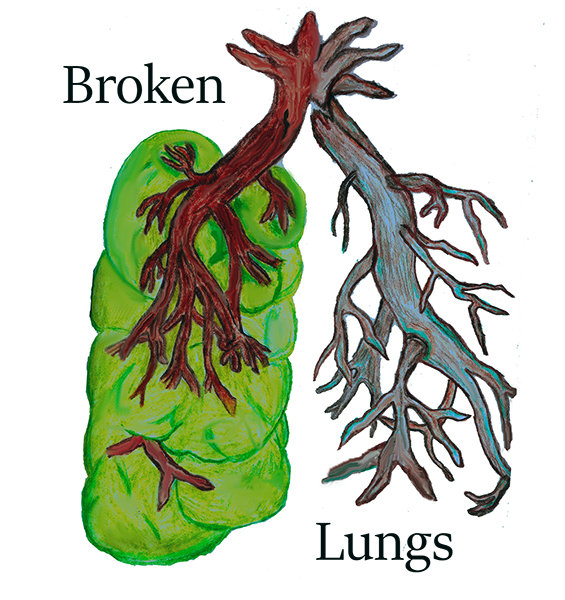 Kickback | Broken Lungs