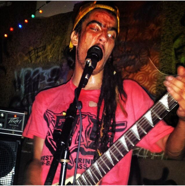 GONOCOCCAL UTERINE BACTERIAL INFECTION | HYPEREMESIS