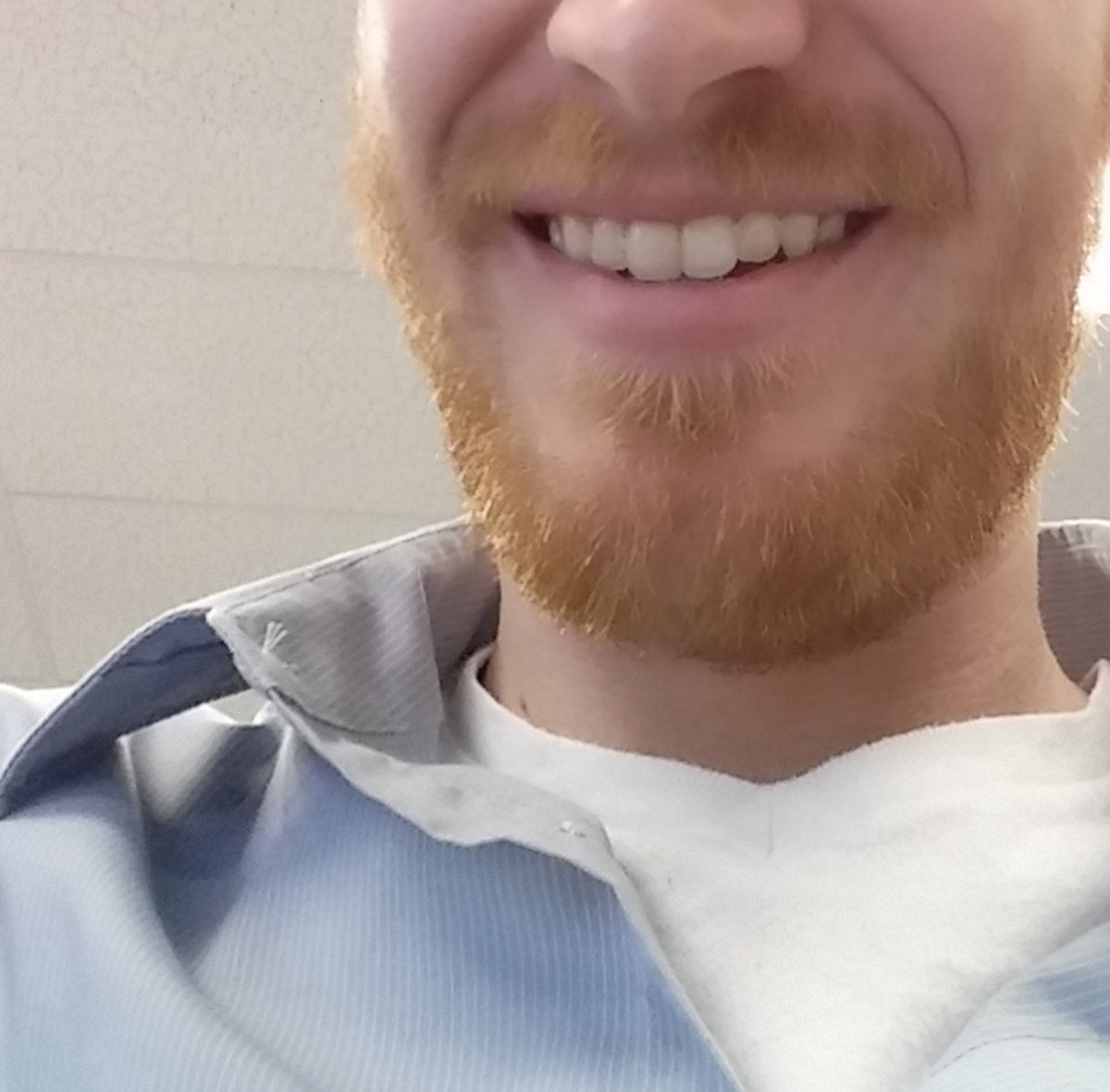 SUPERGYRO | brian little