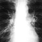 On Strange Loops | Mithras | Willowtip