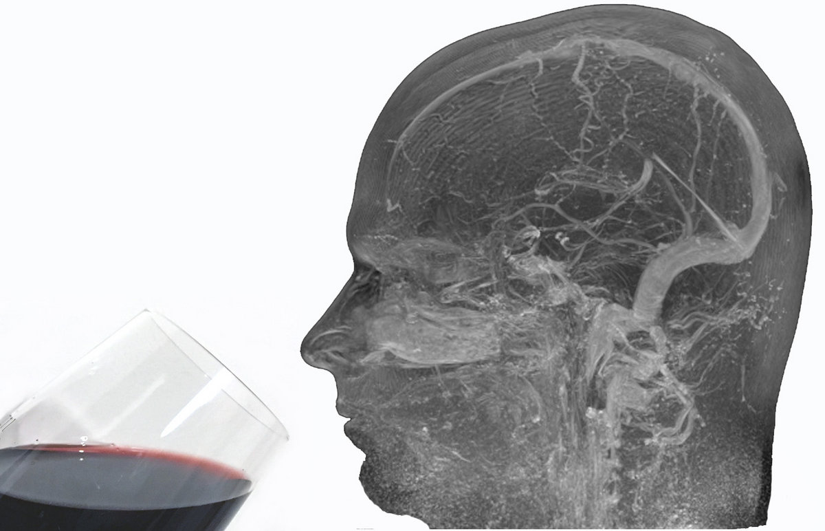 All tubes | vicmod weinglas