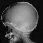 Sharp Like A Razor | Clouds | Headstrong