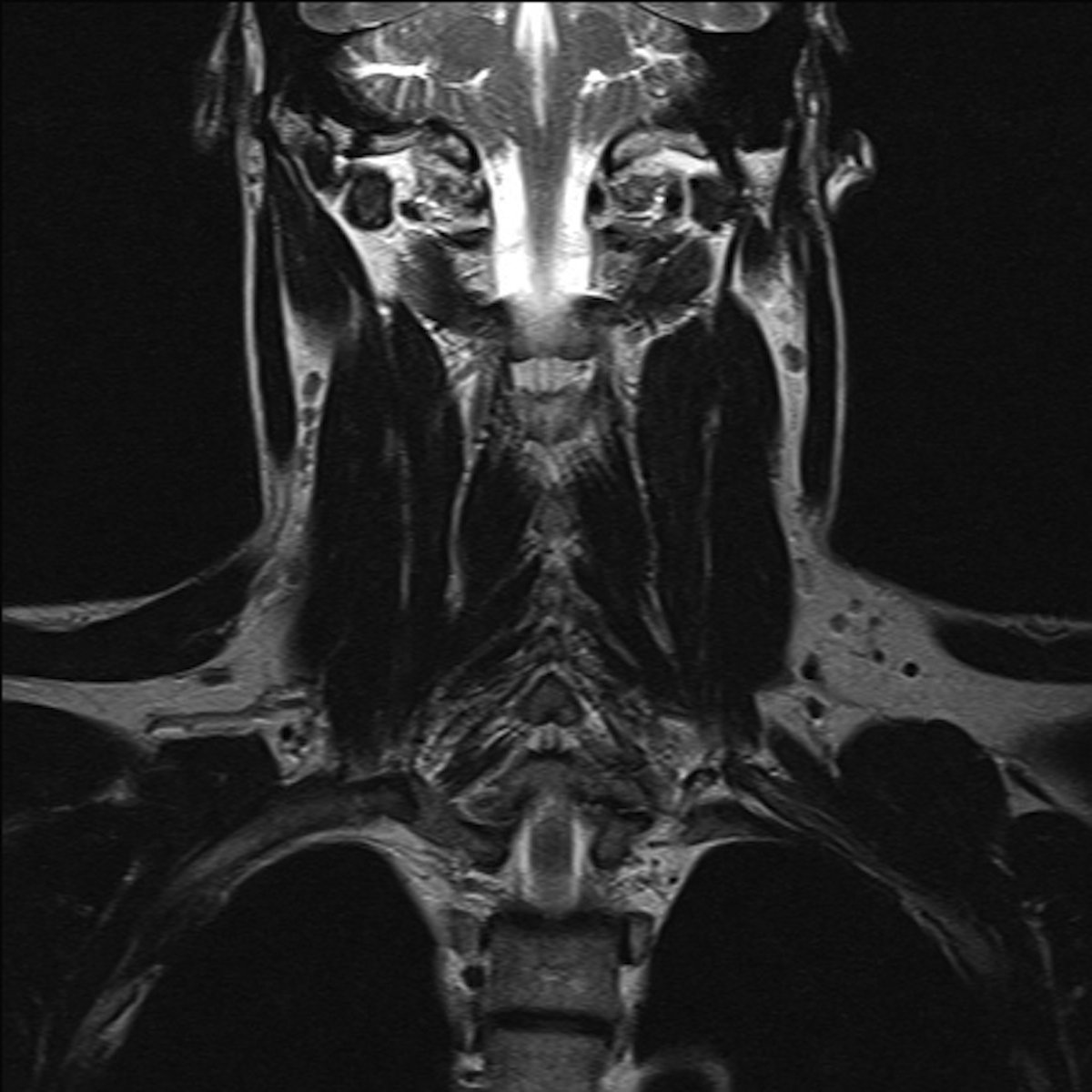 MRI | MRI - Patricia Bosshard & Simon Grab | Simon Grab