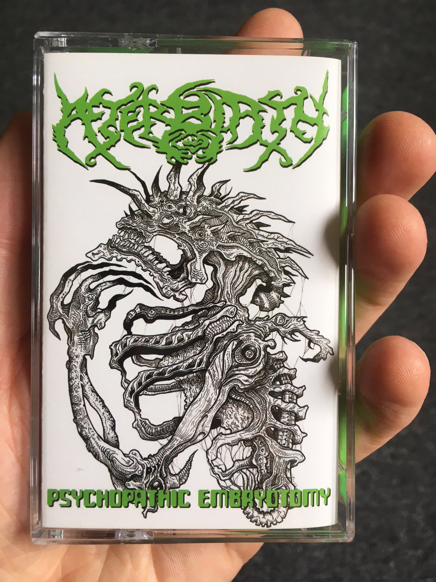 Psychopathic Embryotomy | Afterbirth