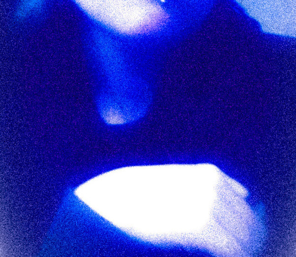 New Future Vision | Blue Surgeon