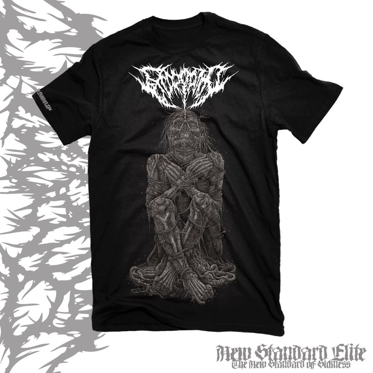 Excoriation | Excoriation