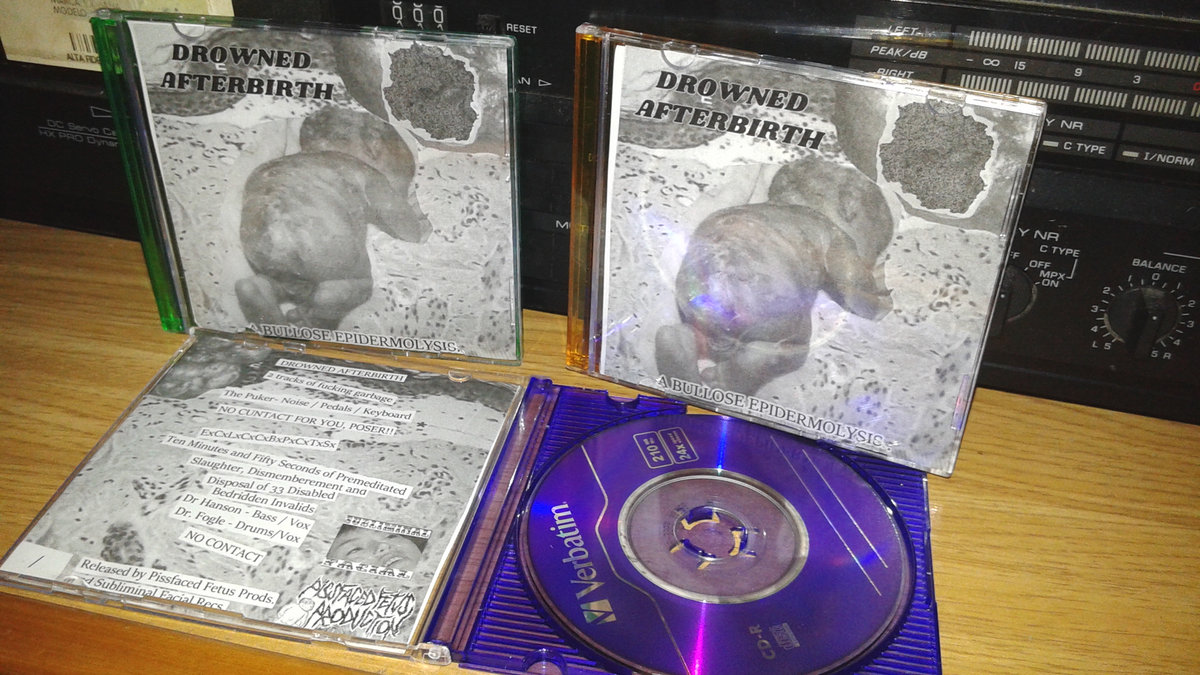A Bullose Epidermolysis... Mini 8" CDr | Drowned Afterbirth ...