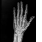 Empress/Abscess | Immortal Bird