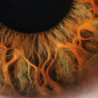 Eosphoros | Eosphoros