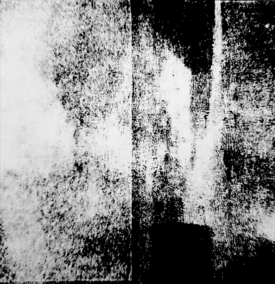 The Fissure of Rolando | Rovellasca