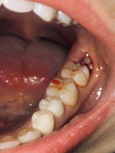 Merch | Le Butcherettes