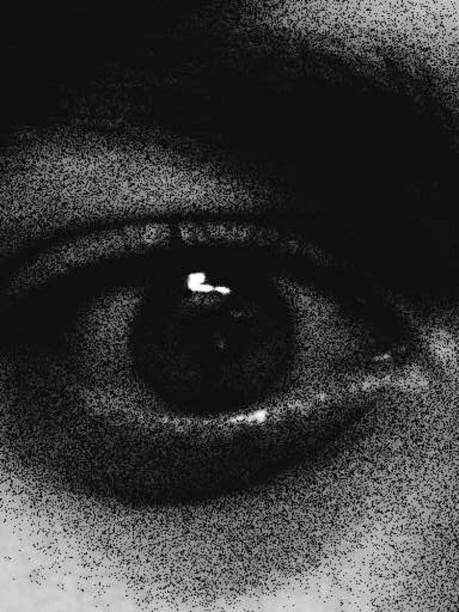 I Songs As Alternatives To Suicide Subconjunctival Hemorrhage 4862