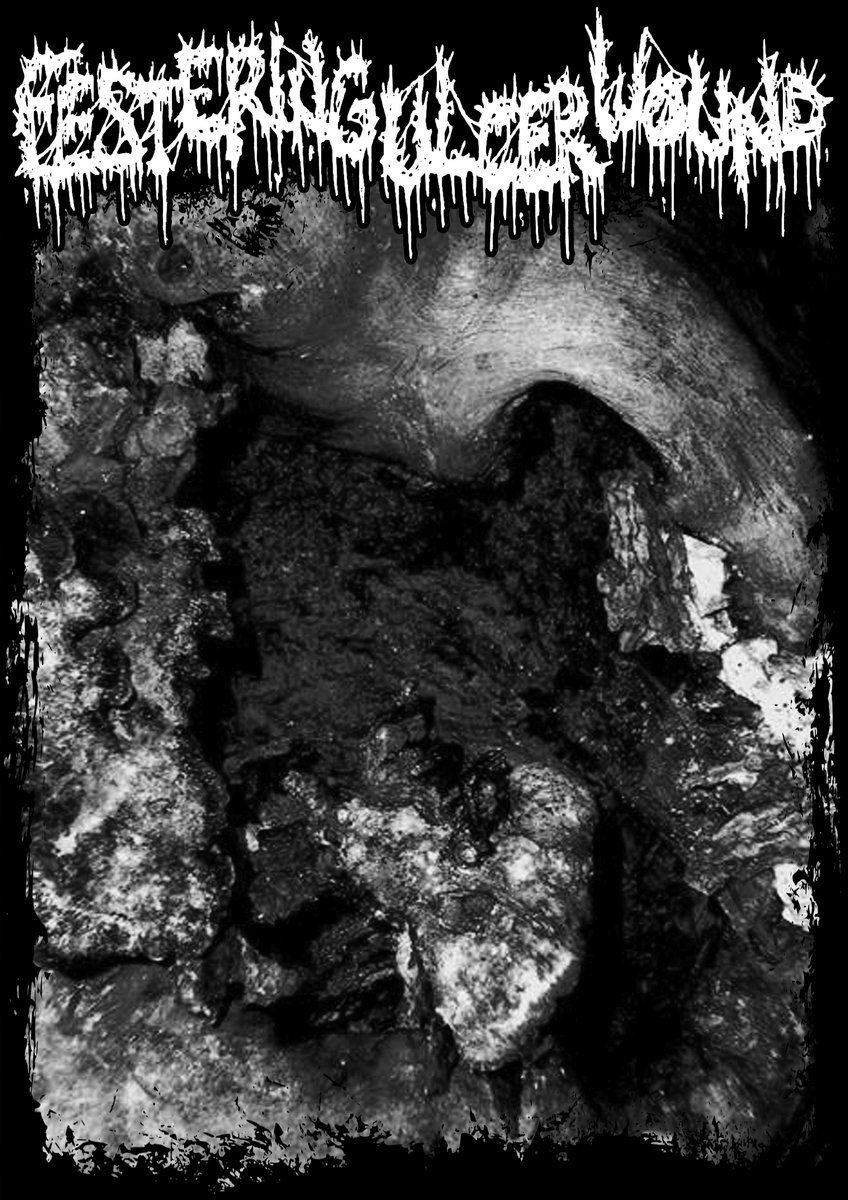 Colonizing the human stomach with bacteria | Festering Ulcer Wound