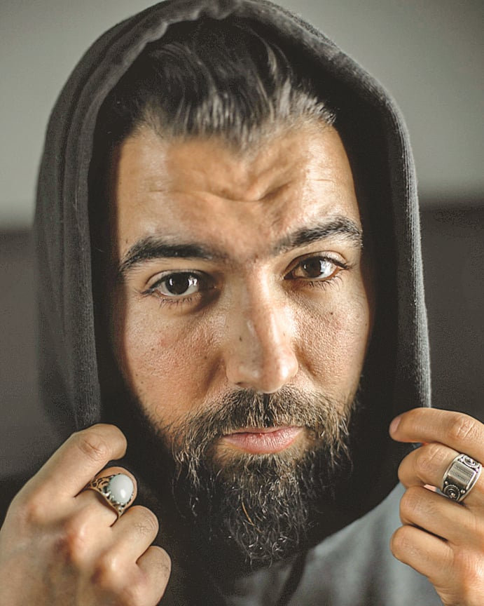 Acouphene | Adil Hiani