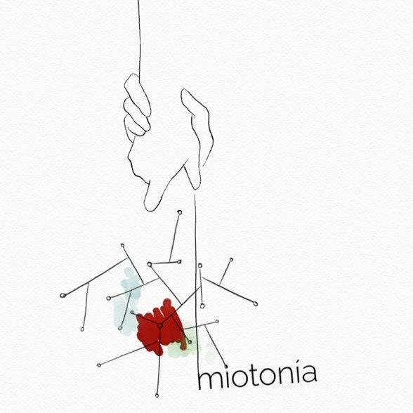 Miotonía | MIOTONÍA