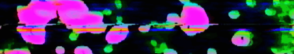 AESTHETICADELICA | BLOODbath64