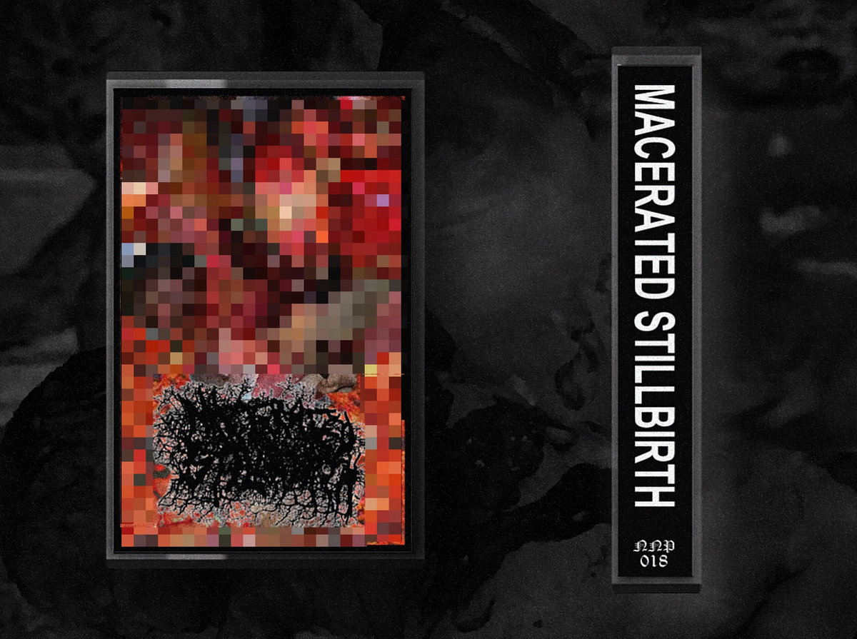 Macerated Stillbirth | Macerated Stillbirth | Nihilistic Noise Propaganda