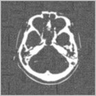 Elevator Grips | Elevator Grips