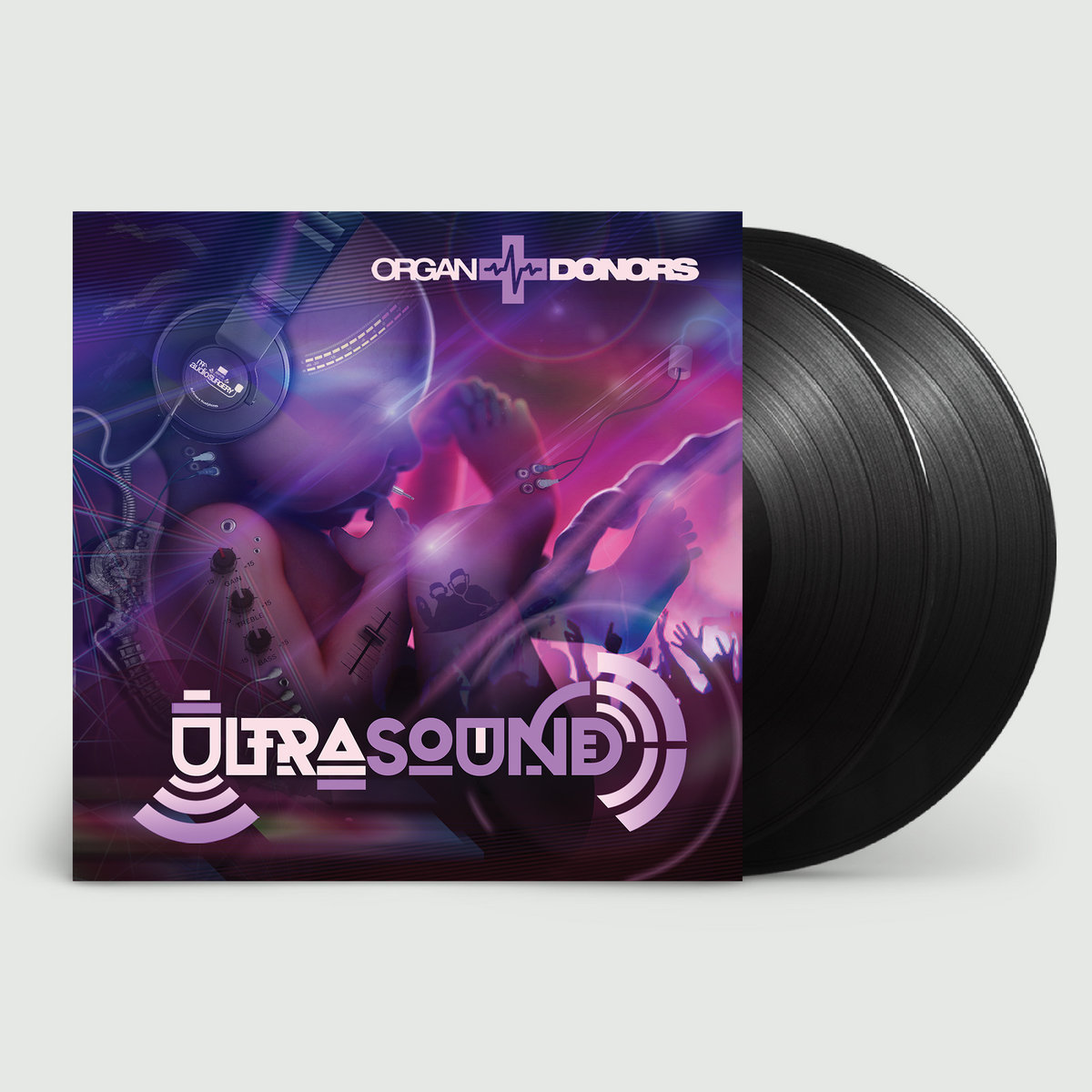 ULTRASOUND | Organ Donors