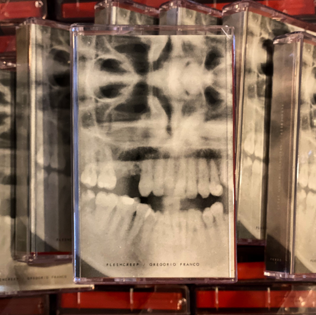 Split with Gregorio Franco | Fleshcreep