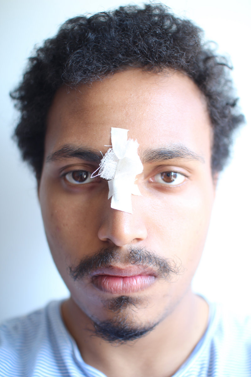 Purée Tan | Gabriel Achilles Bellone