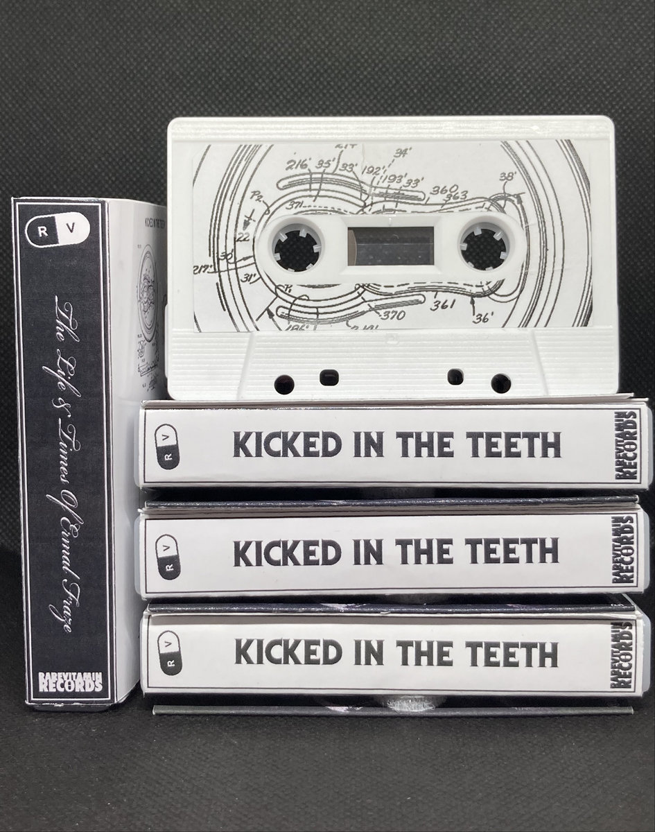 The Life and Times Of Ermal Fraze | Kicked In The Teeth | Rare Vitamin ...