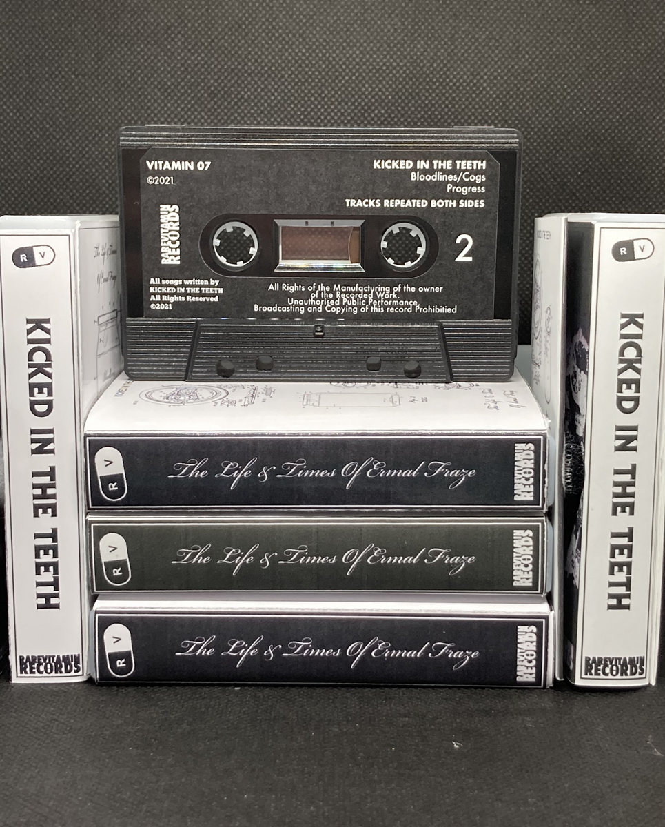 The Life and Times Of Ermal Fraze | Kicked In The Teeth | Rare Vitamin ...