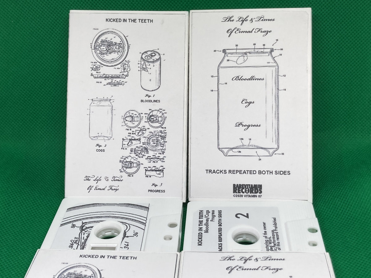 The Life and Times Of Ermal Fraze | Kicked In The Teeth | Rare Vitamin ...