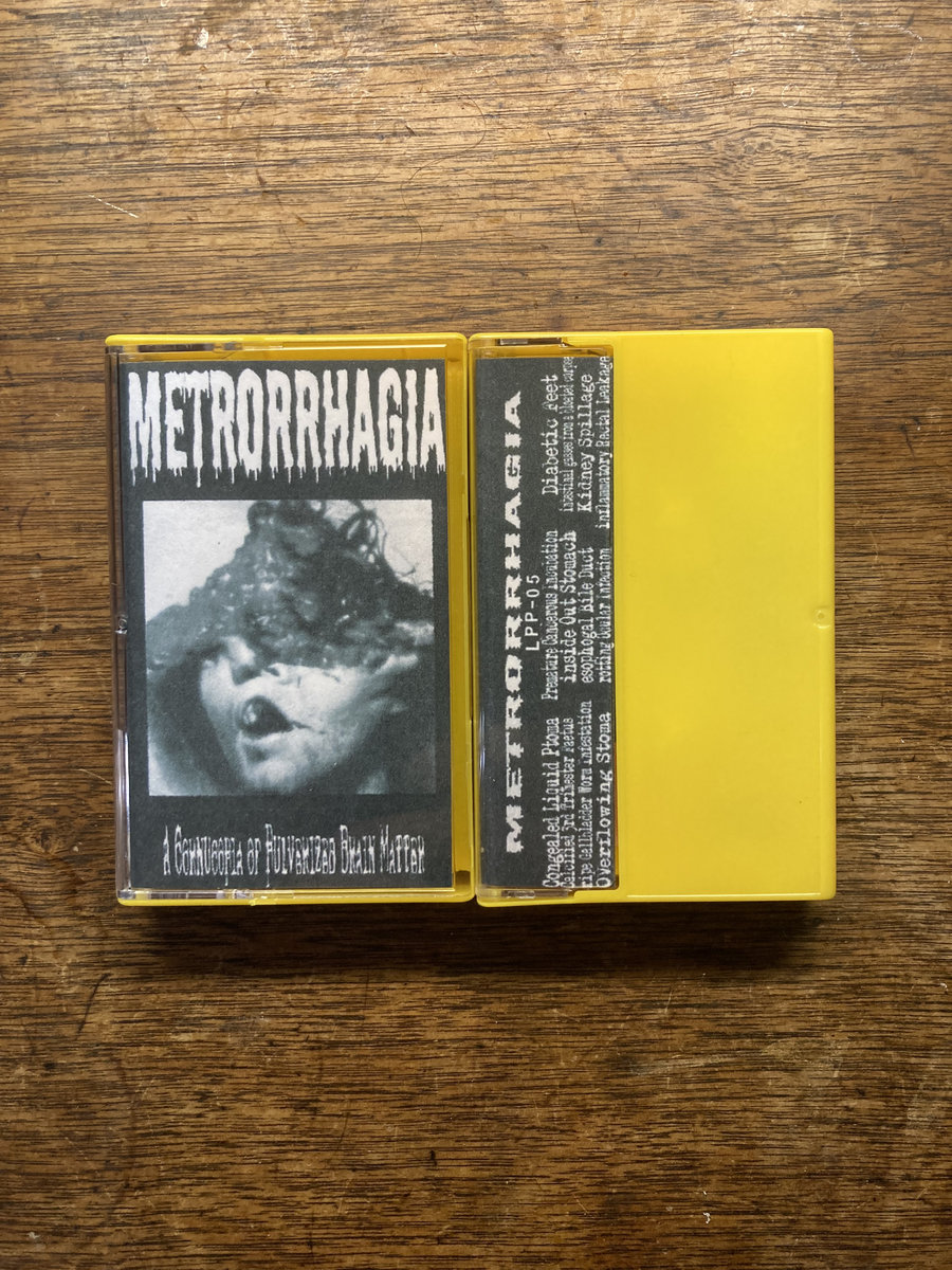 A Cornucopia Of Pulverized Brain Matter | Metrorrhagia | Liquid ...