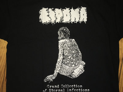 Lipoma T-Shirt | Lipoma