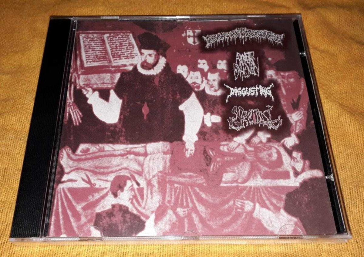 Body Stalk Anomaly (Defect Of Abdominal Wall Closure) | Rotten Foetus ...