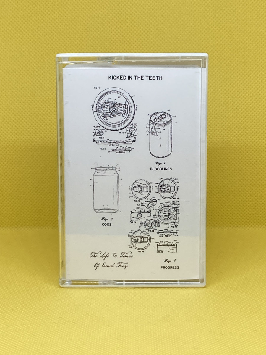 The Life and Times Of Ermal Fraze | Kicked In The Teeth | Rare Vitamin ...