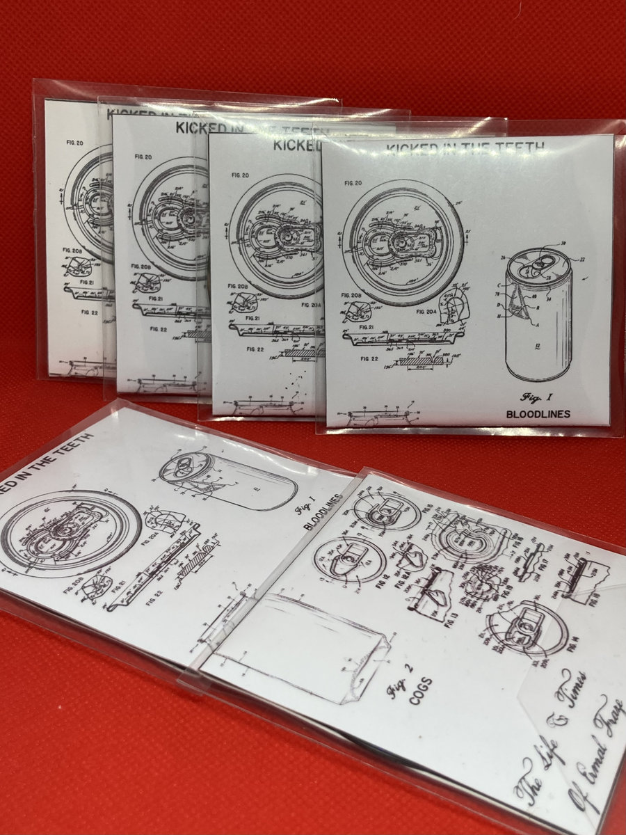 The Life and Times Of Ermal Fraze | Kicked In The Teeth | Rare Vitamin ...