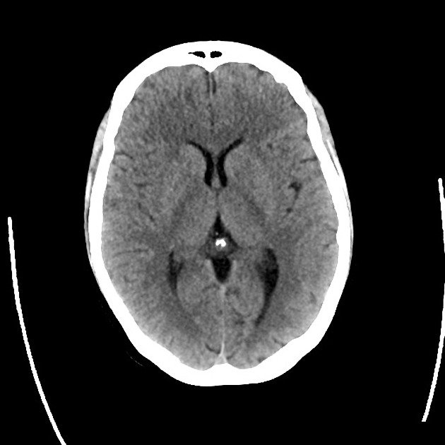 Rain Song | Maitland Parade