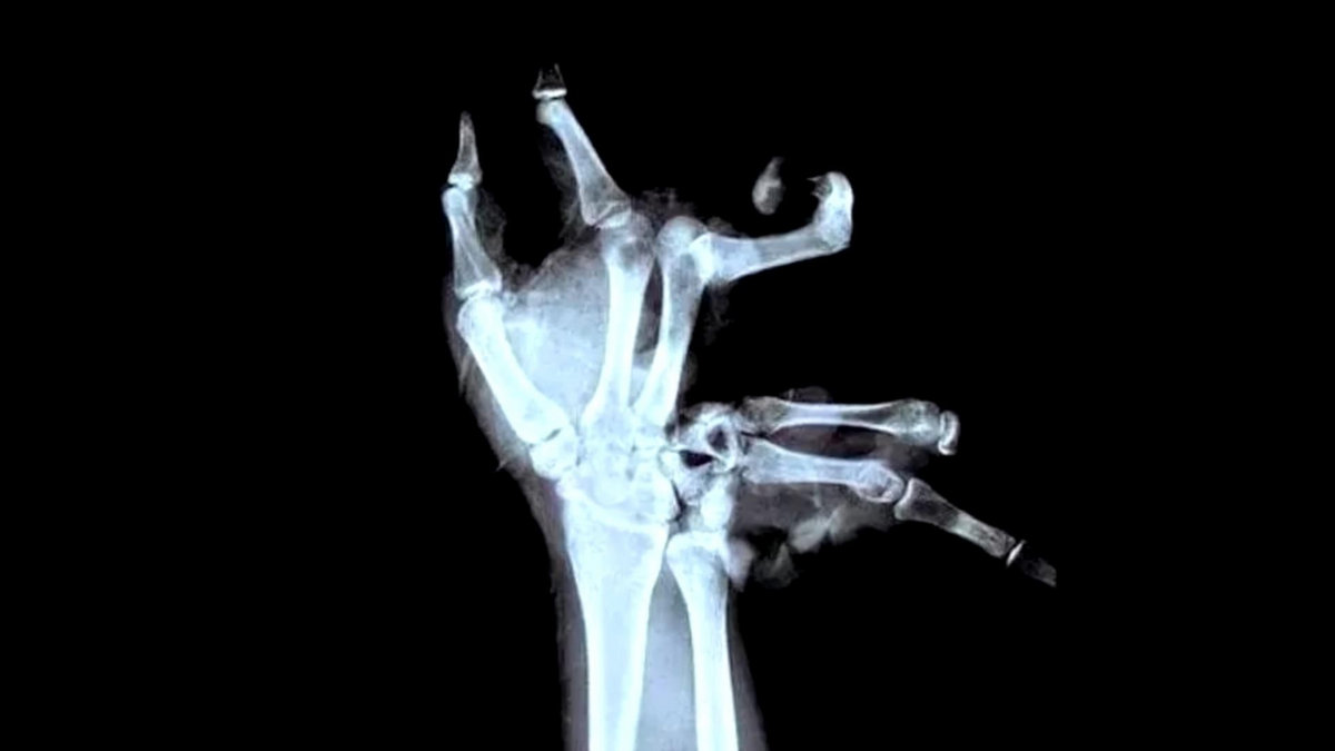 Void Patterns | NIHILNIHILNIHILIST