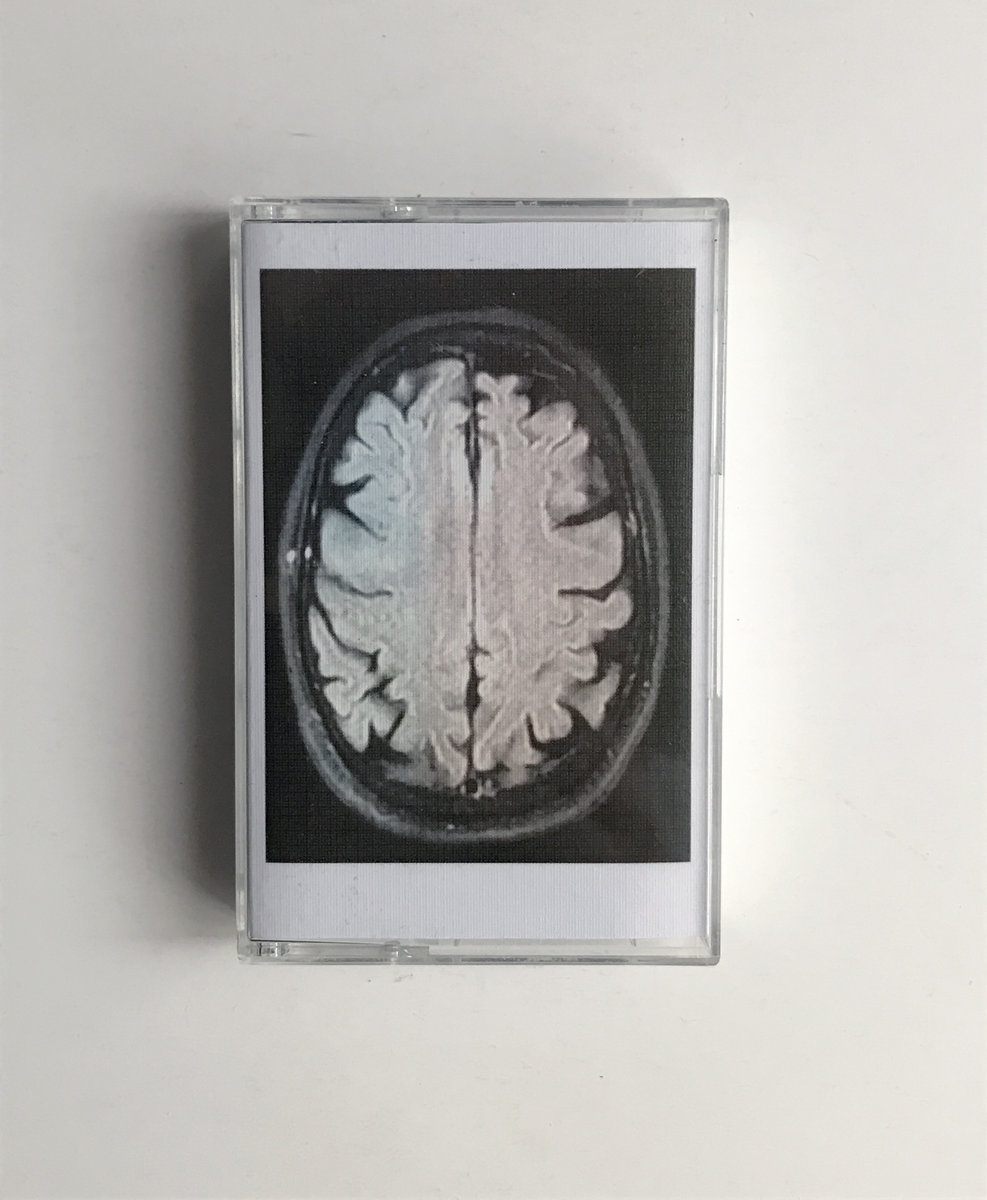 Agave Azul | L'eclipse Nue | Silencio EPI