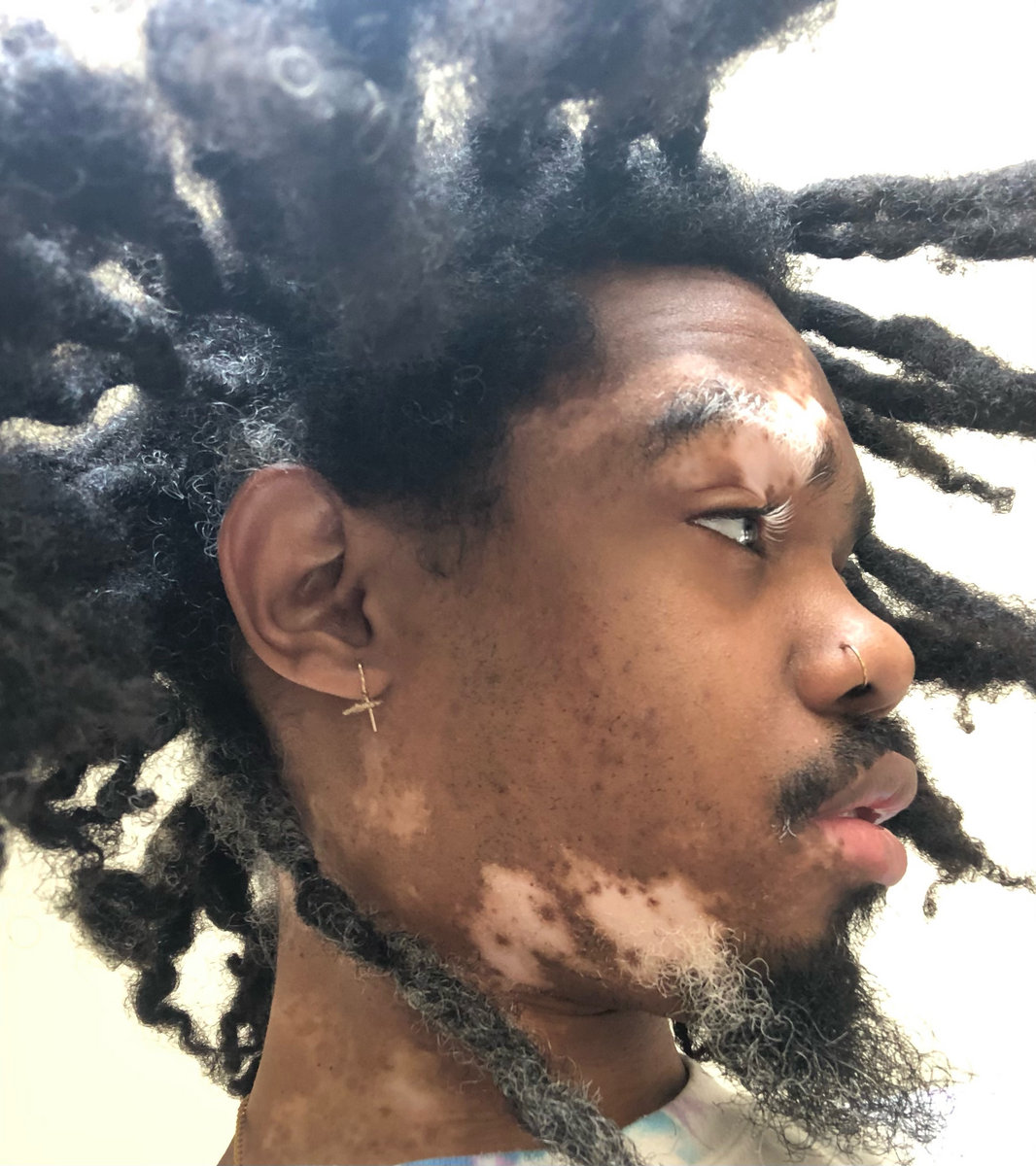 Starving Stoner | Mr. Yang