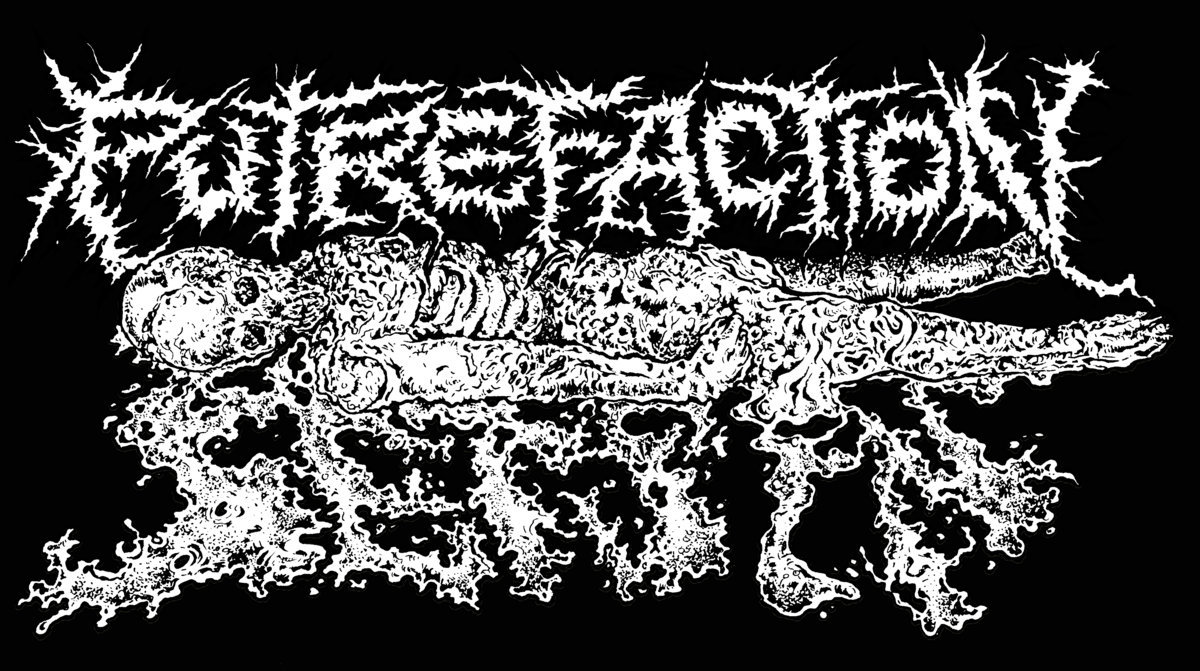 Vibices and Sugillations | PUTREFACTION SETS IN