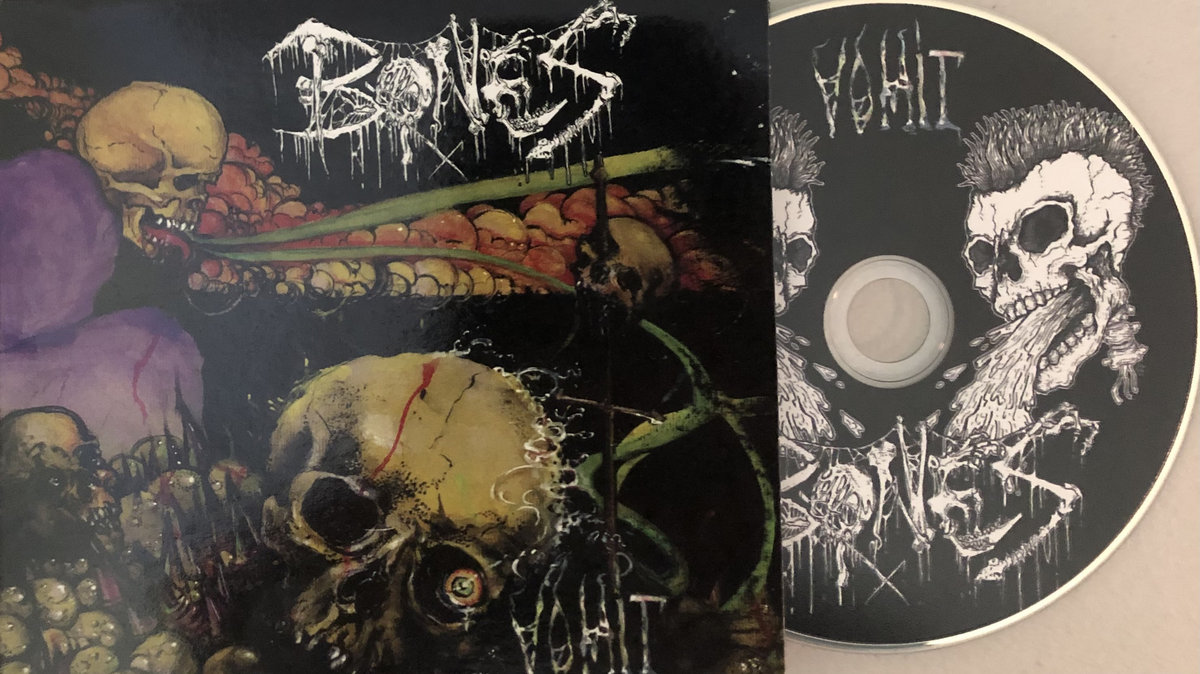 Vomit | BONES