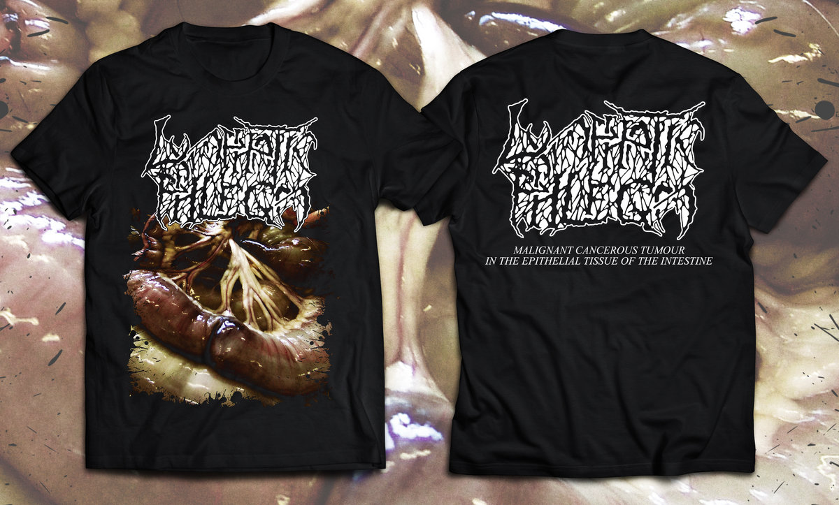 LYMPHATIC PHLEGM - Malignant Cancerous Tumor...(M-XXL) T-Shirt | Morbid ...