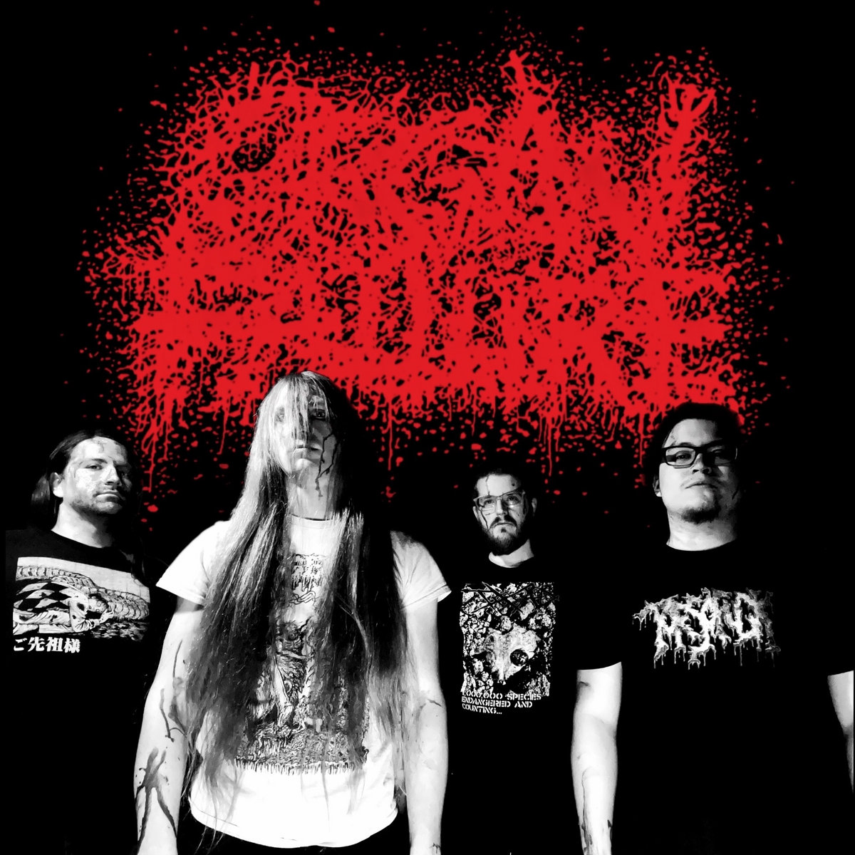 Music | Organ Failure