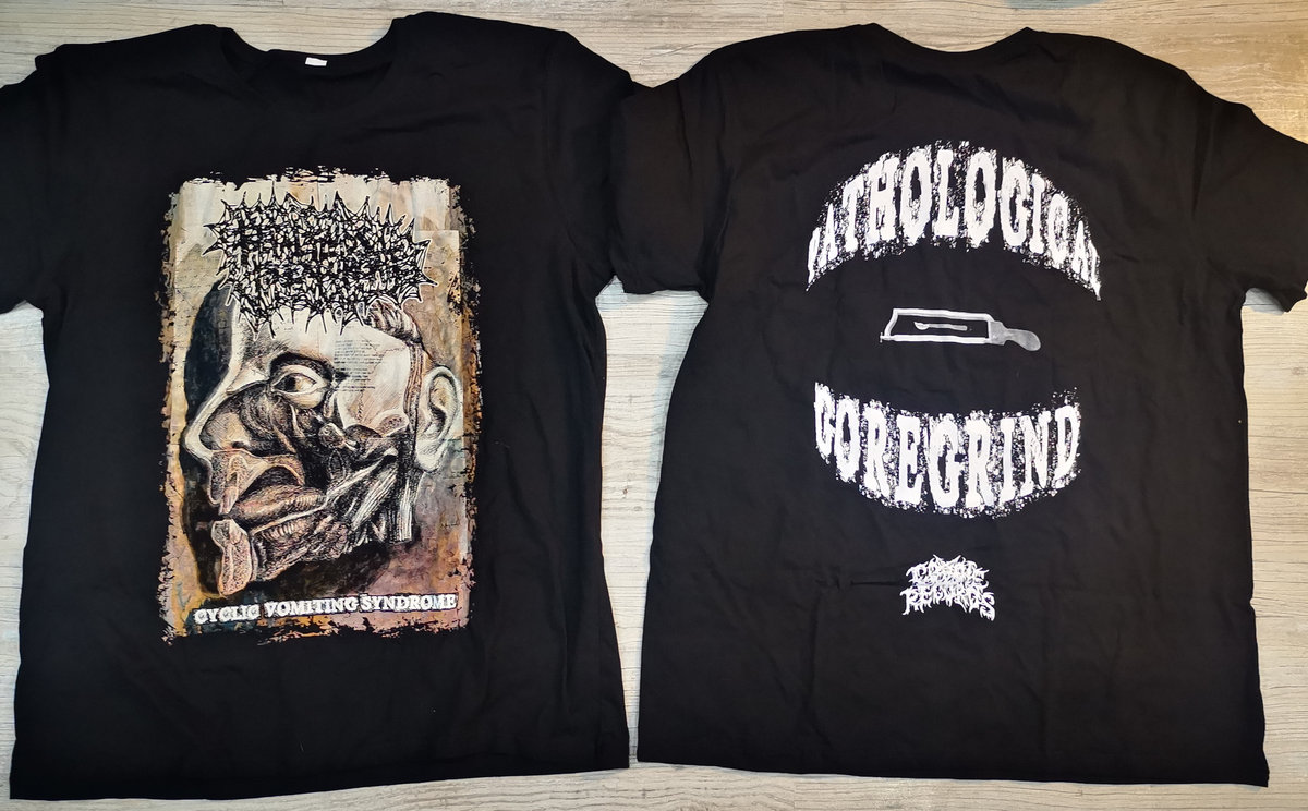 Cyclic Vomiting Syndrome | FOETAL FLUIDS TO EXPURGATE | coyoterecords