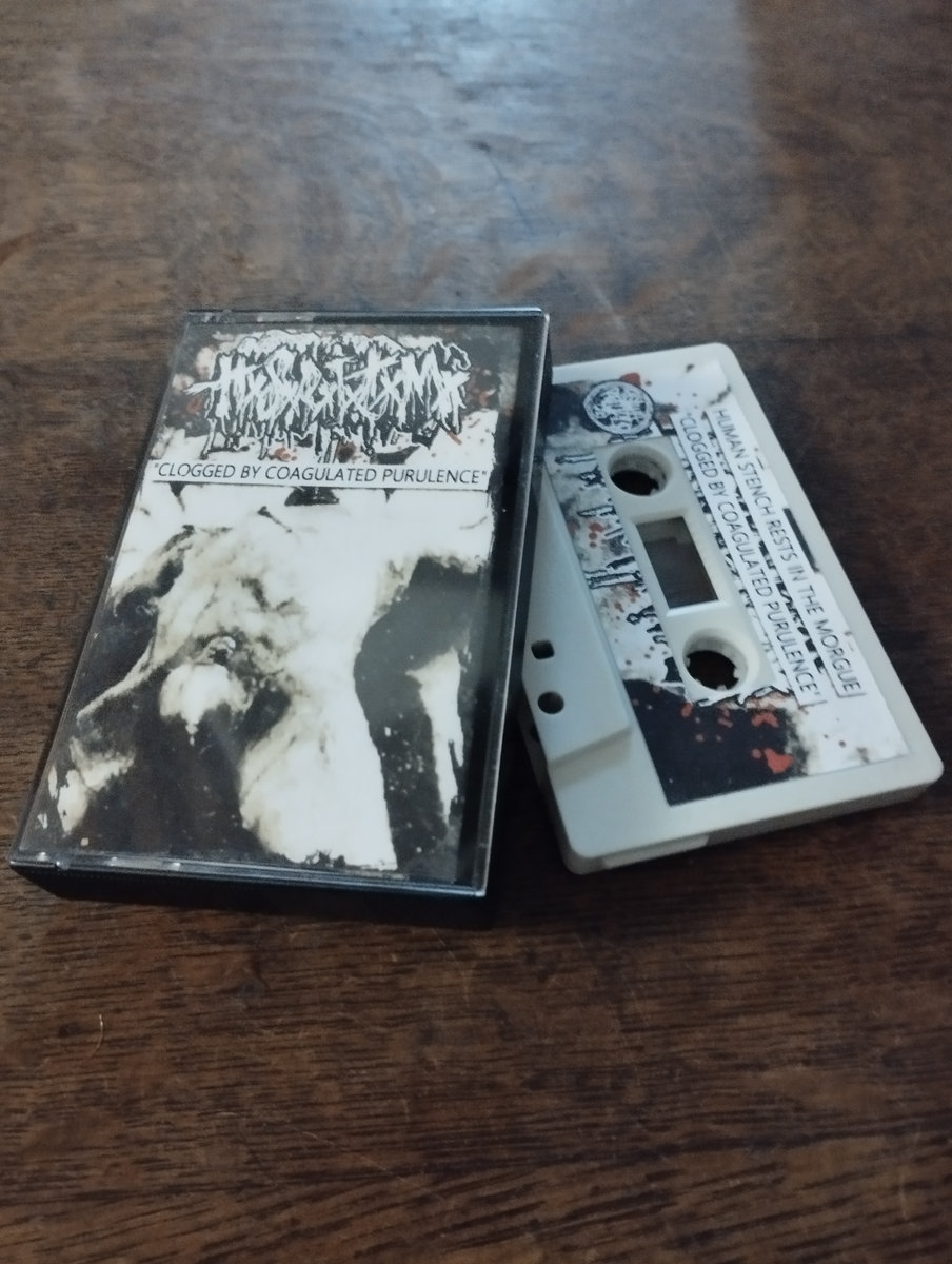 Clogged By Coagulated Purulence | Human Stench Rests In The Morgue
