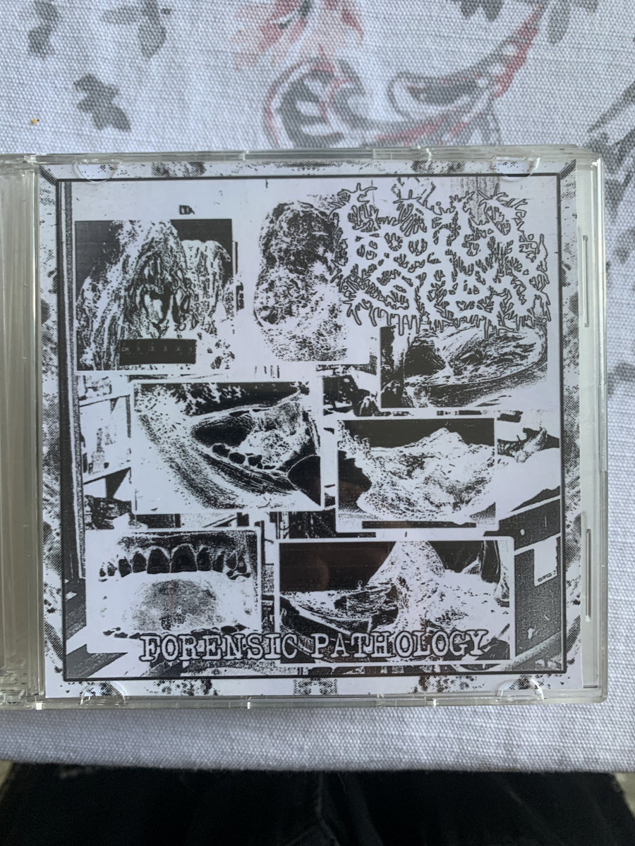 FORENSIC PATHOLOGY | BODILY STEW