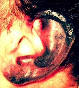 Music | Rotting Ears