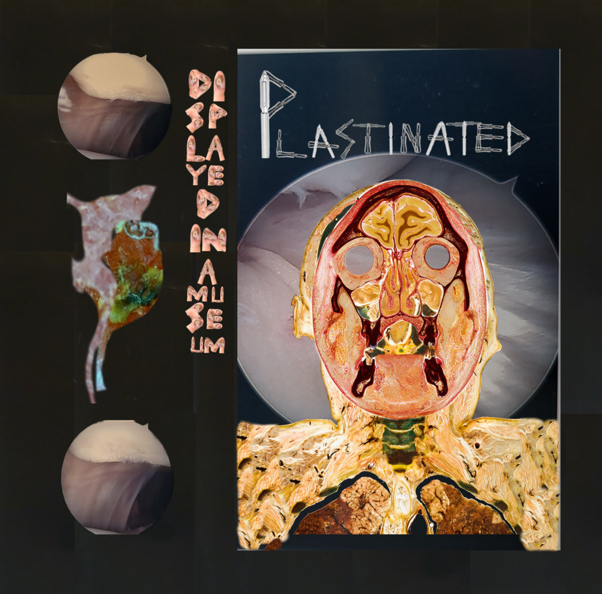 Displayed In a Museum | Plastinated