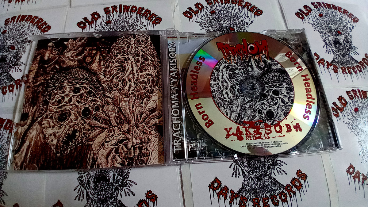 Trachoma - Adipocere Corpse Wax | Trachoma / Yakisoba | Old Grindered ...