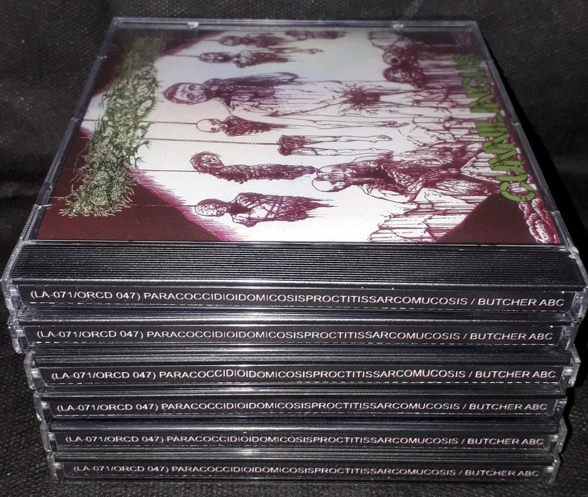 PARACOCCIDIOIDOMICOSISPROCTITISSARCOMUCOSIS / BUTCHER ABC - Split CD ...