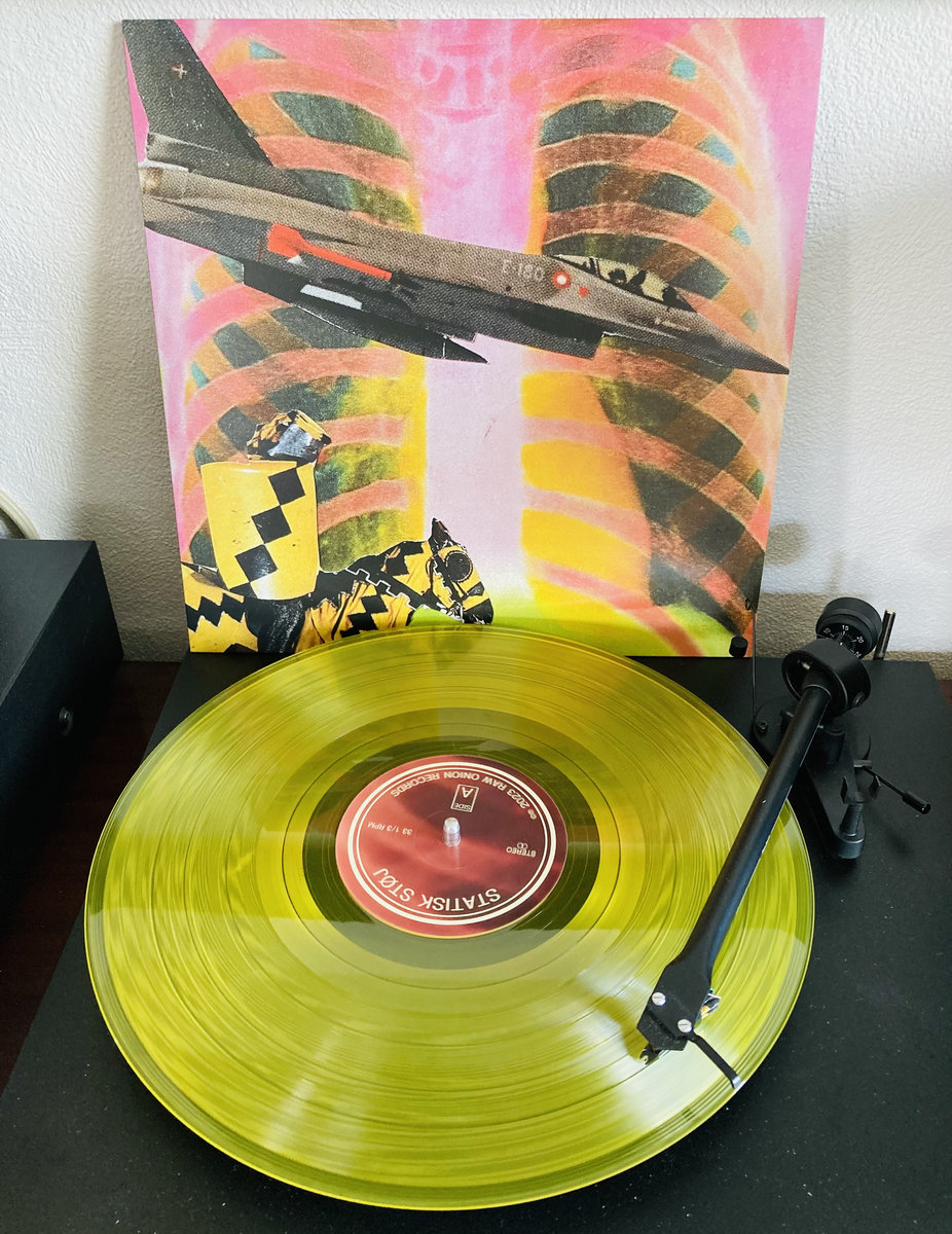 Statisk Støj | Statisk Støj